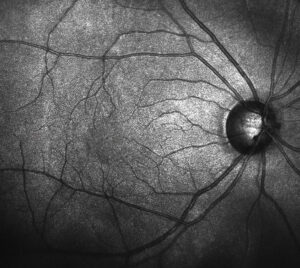 Services - Eyecare At Morrisons